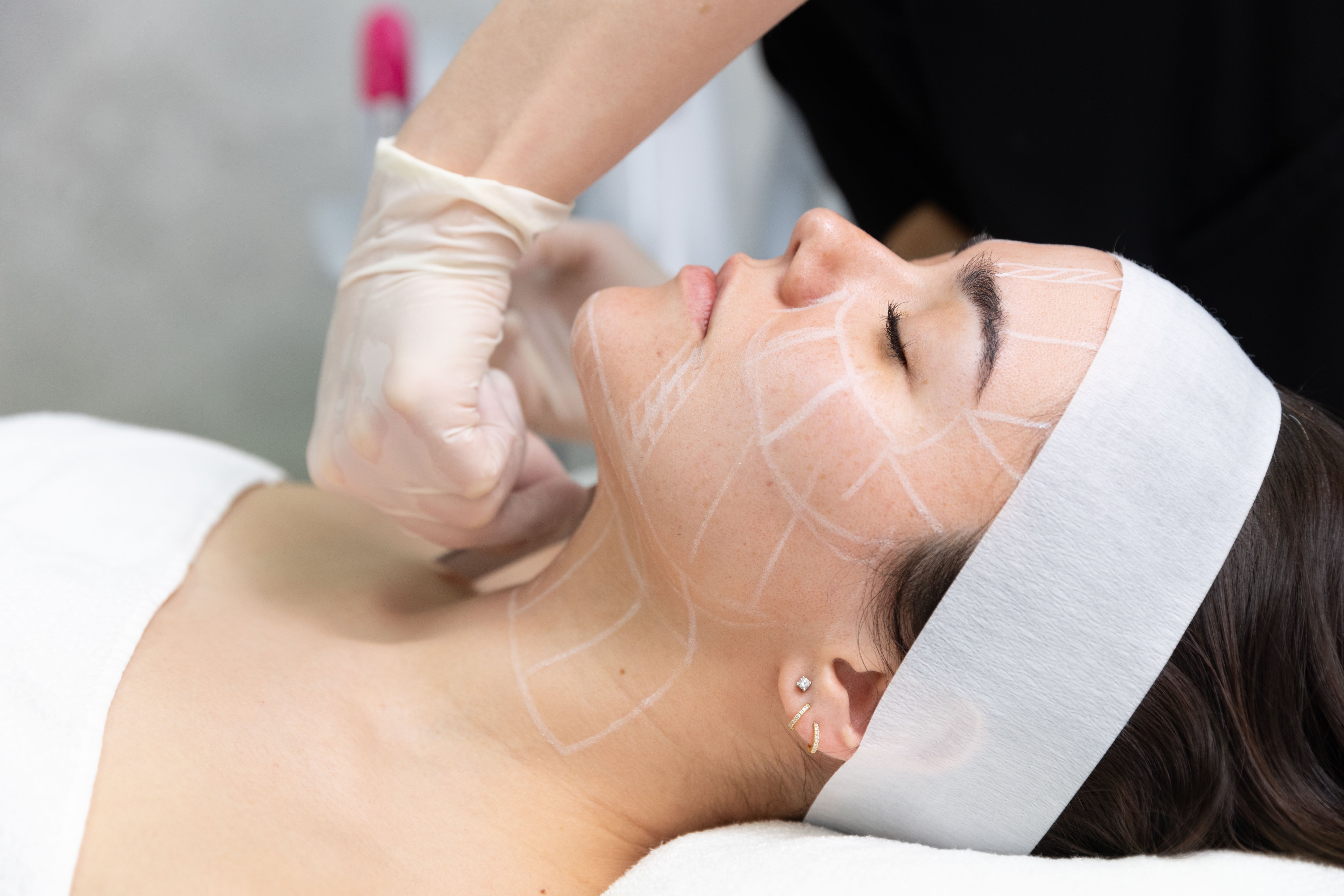 The treatment to achieve a sculpted jawline?