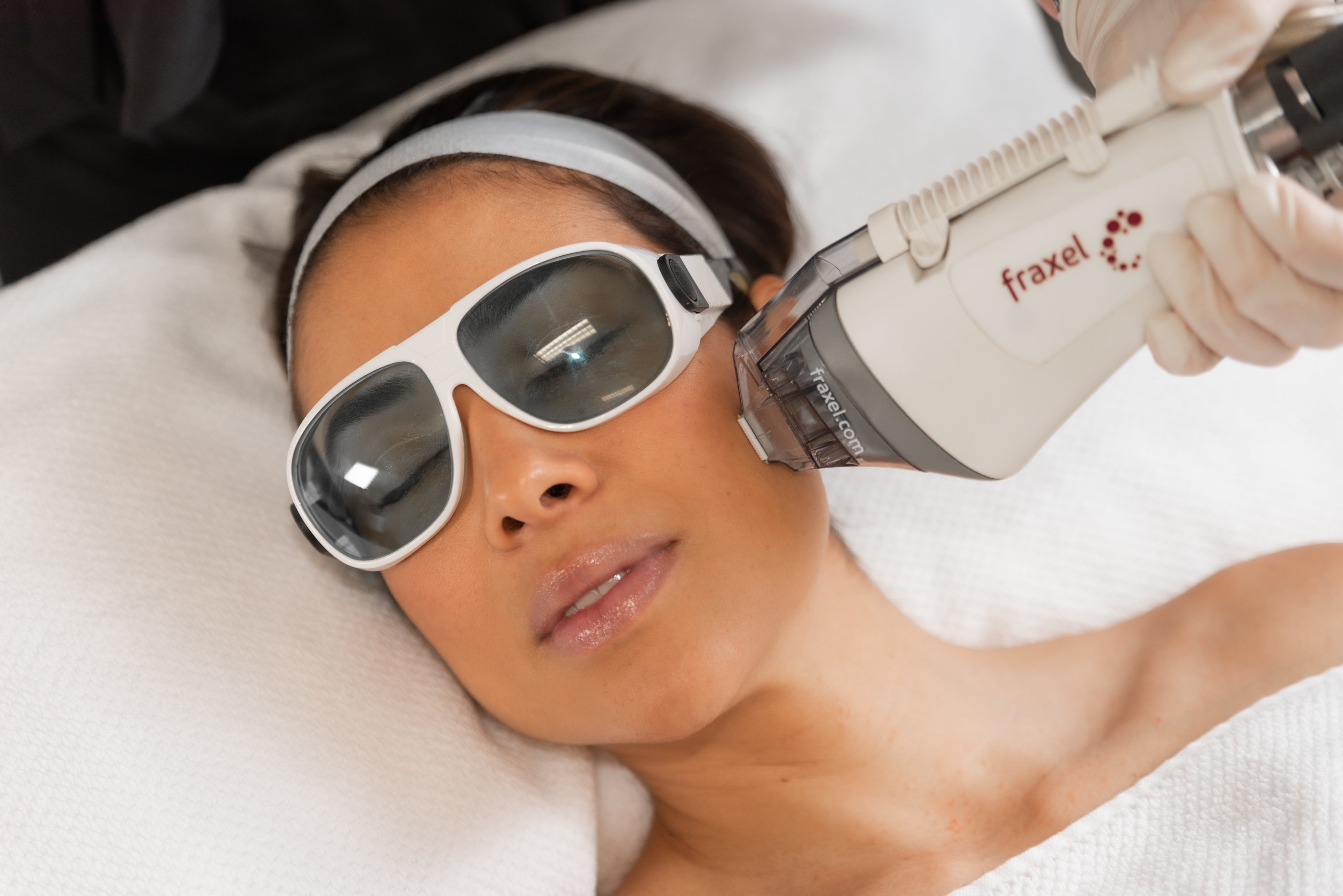 Reboot your Skin this Winter Fraxel Laser: Your Solution for Pigmentat