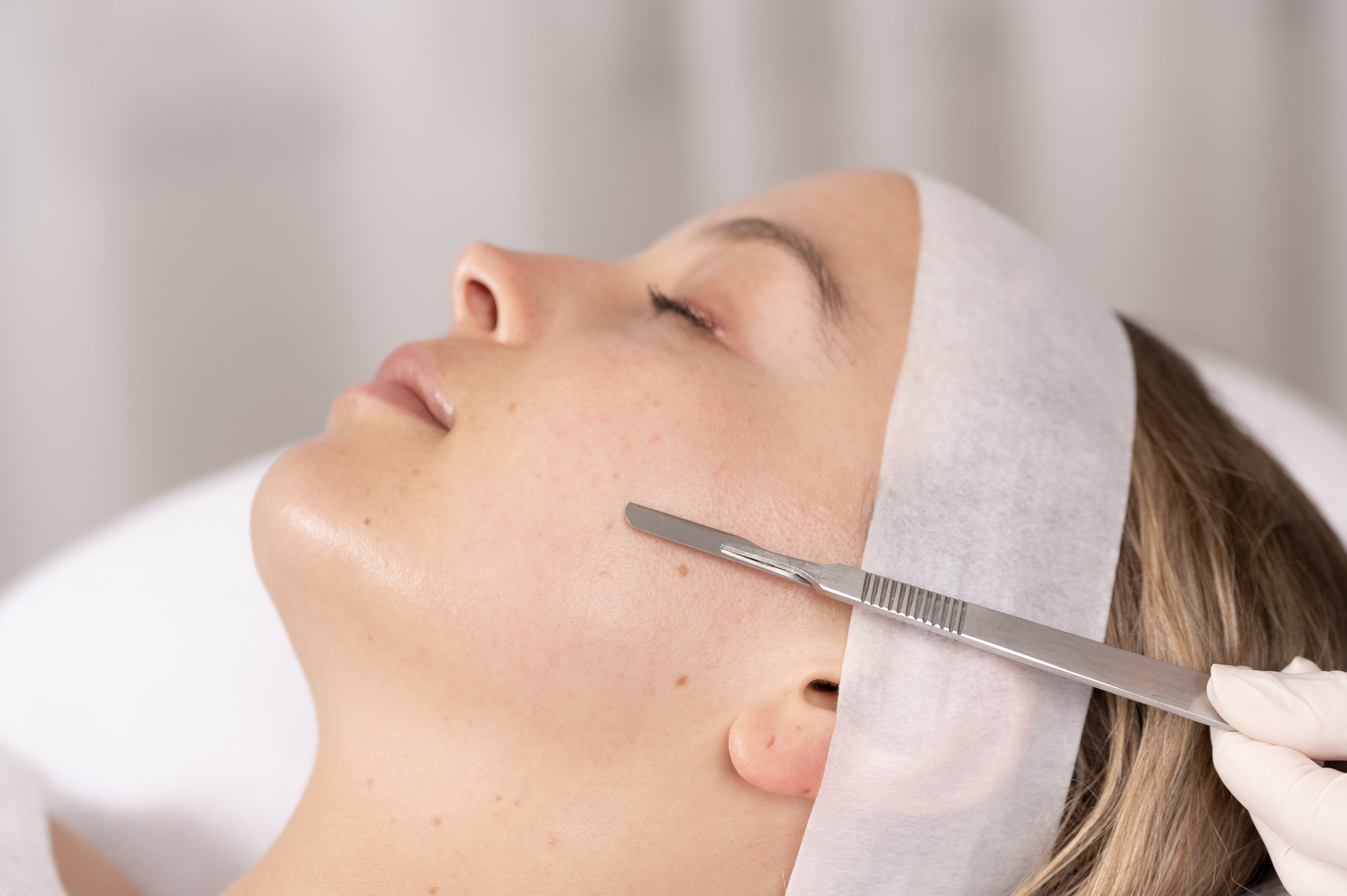 Express Dermaplaning Skin Treatment - The Clinic Bondi